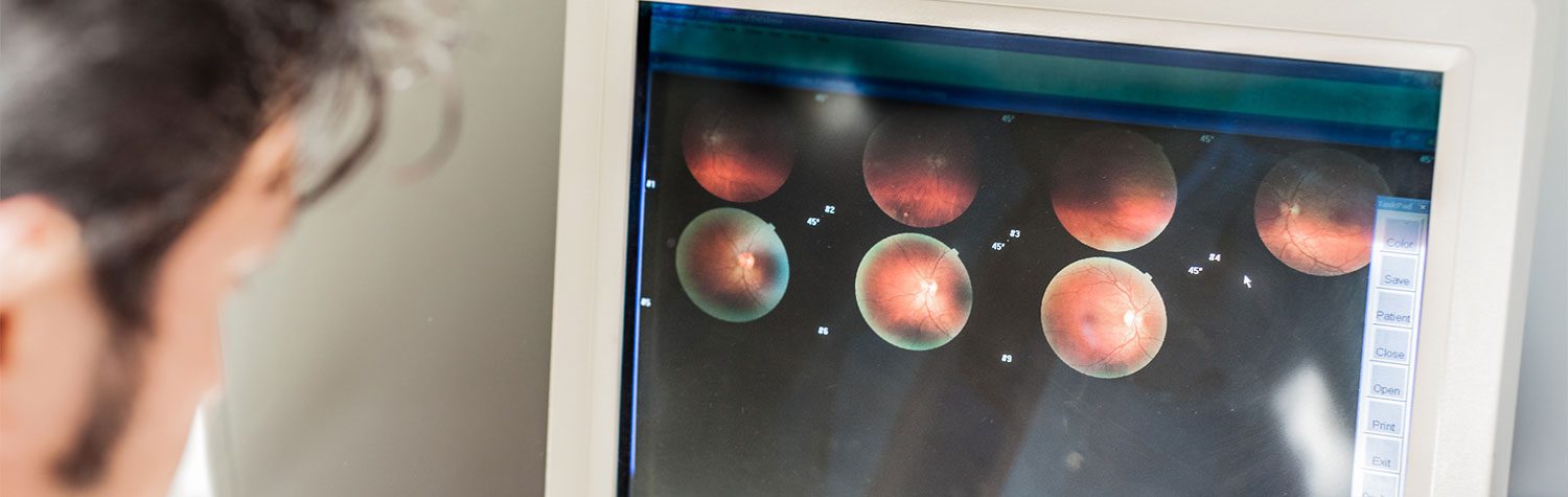 Recovering From Cataract Surgery | Vistar Eye Center